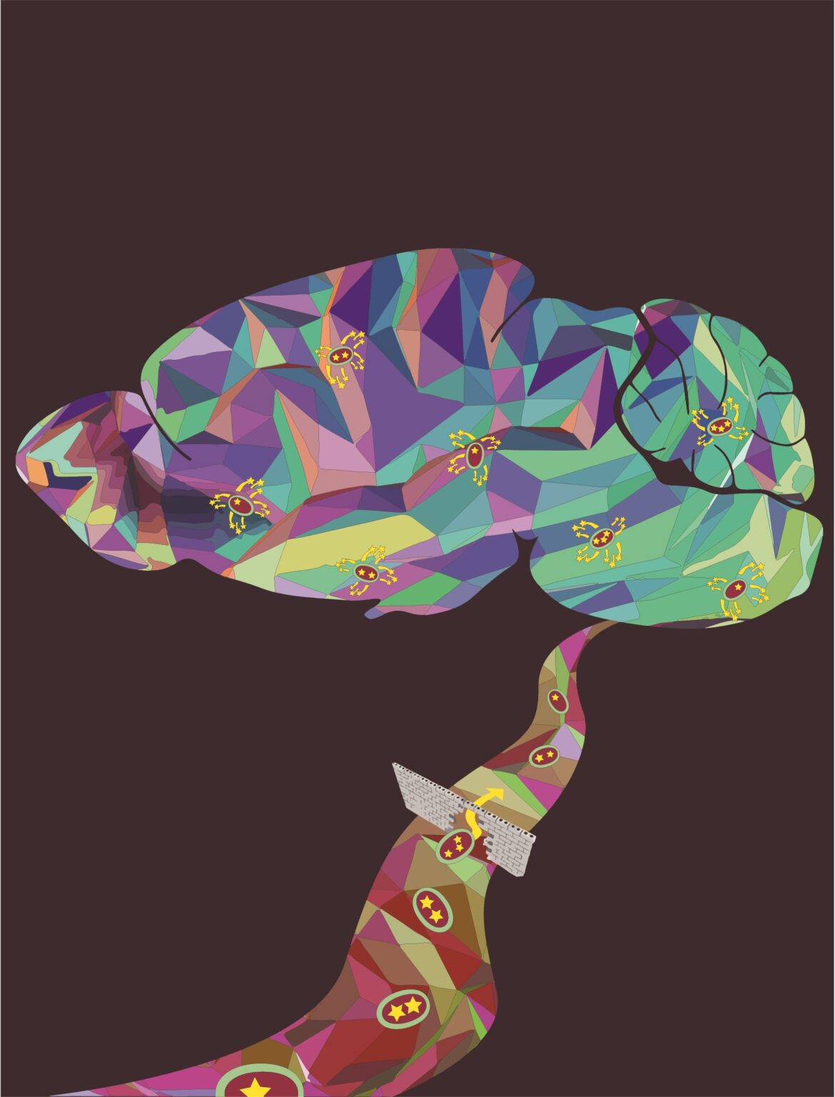 Groundbreaking gene therapy trial for Hunter syndrome opens ...