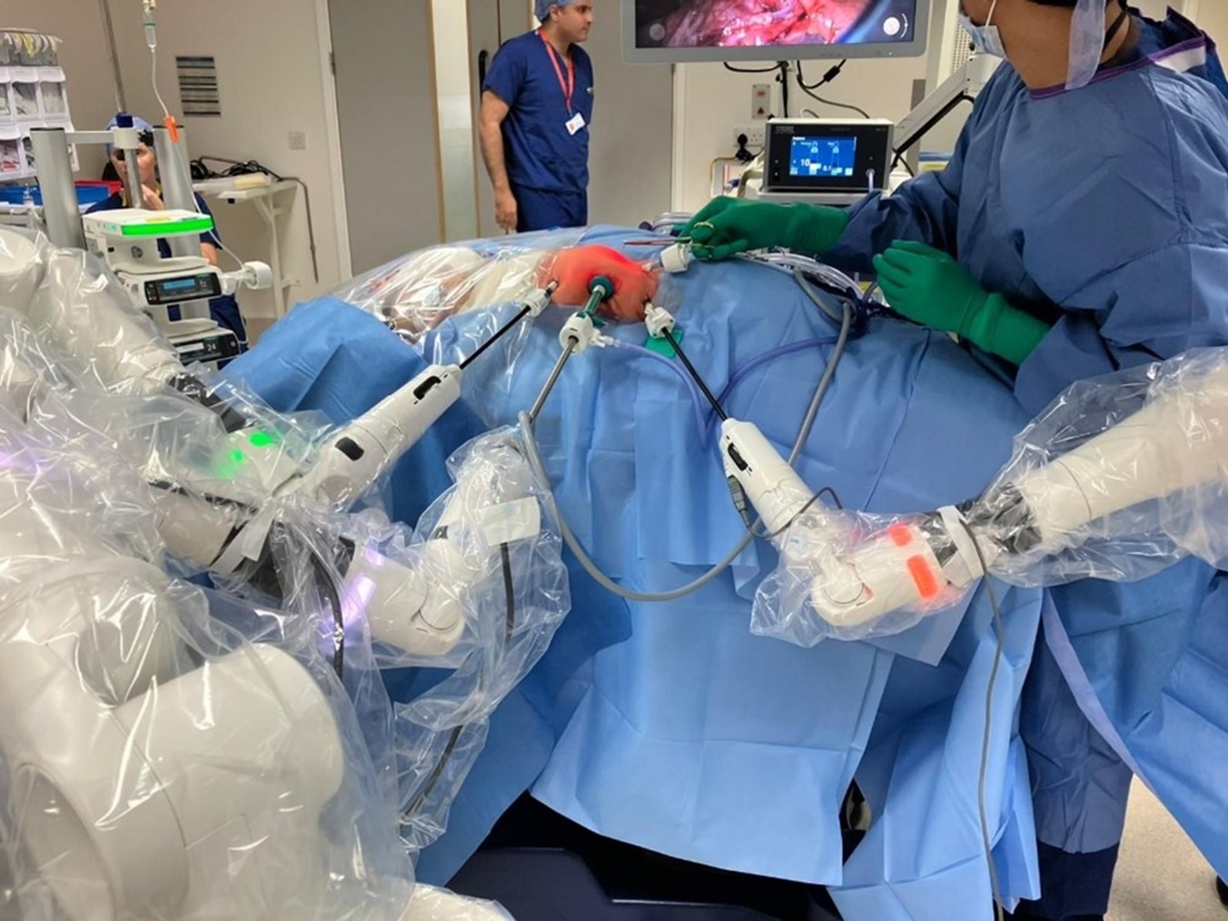 Robotic surgery delivering ‘game-changing’ care for children in ...