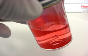 Sample collection, pots and special instructions - Manchester University NHS Foundation Trust